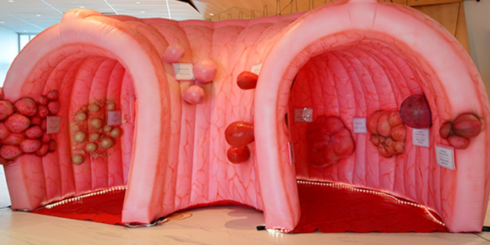 Learn about Colorectal Cancer prevention and screening at the Jumbo ...