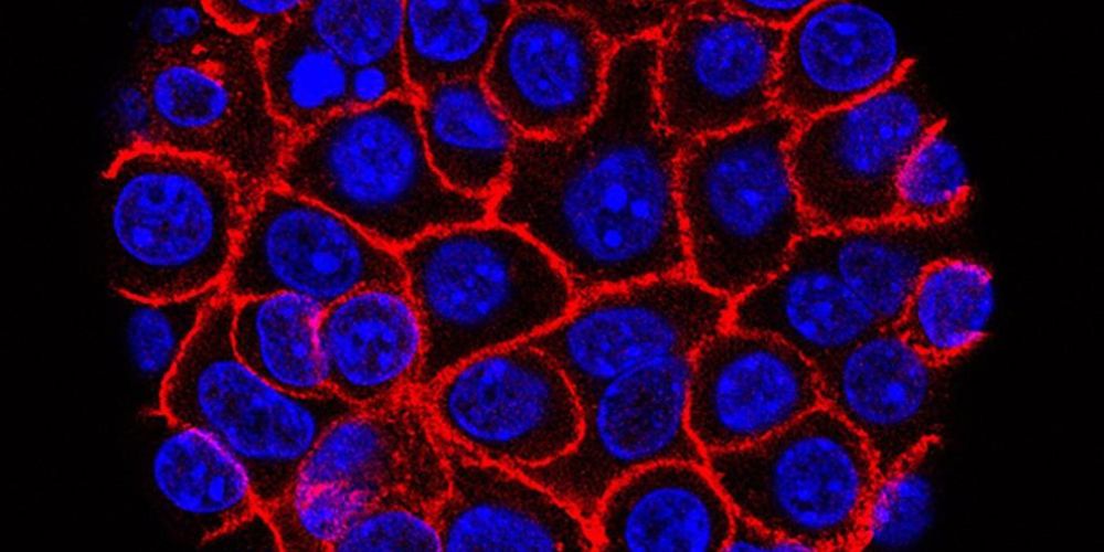 Hope emerges as new pill targets deadly pancreatic cancer | Barrie 360